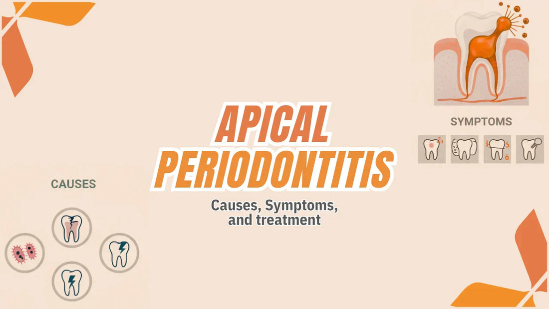 Apical Periodontitis: Causes, Symptoms & Treatment Guide – Akayu